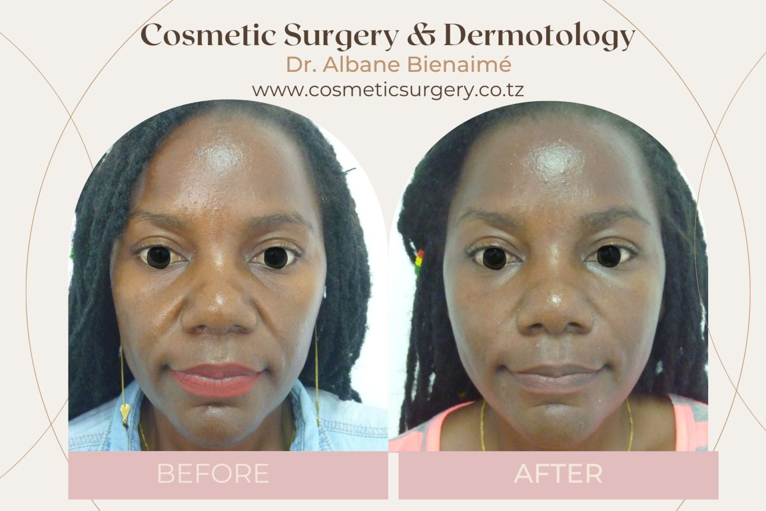 Before and After Procedures – Medical and Surgical Clinic